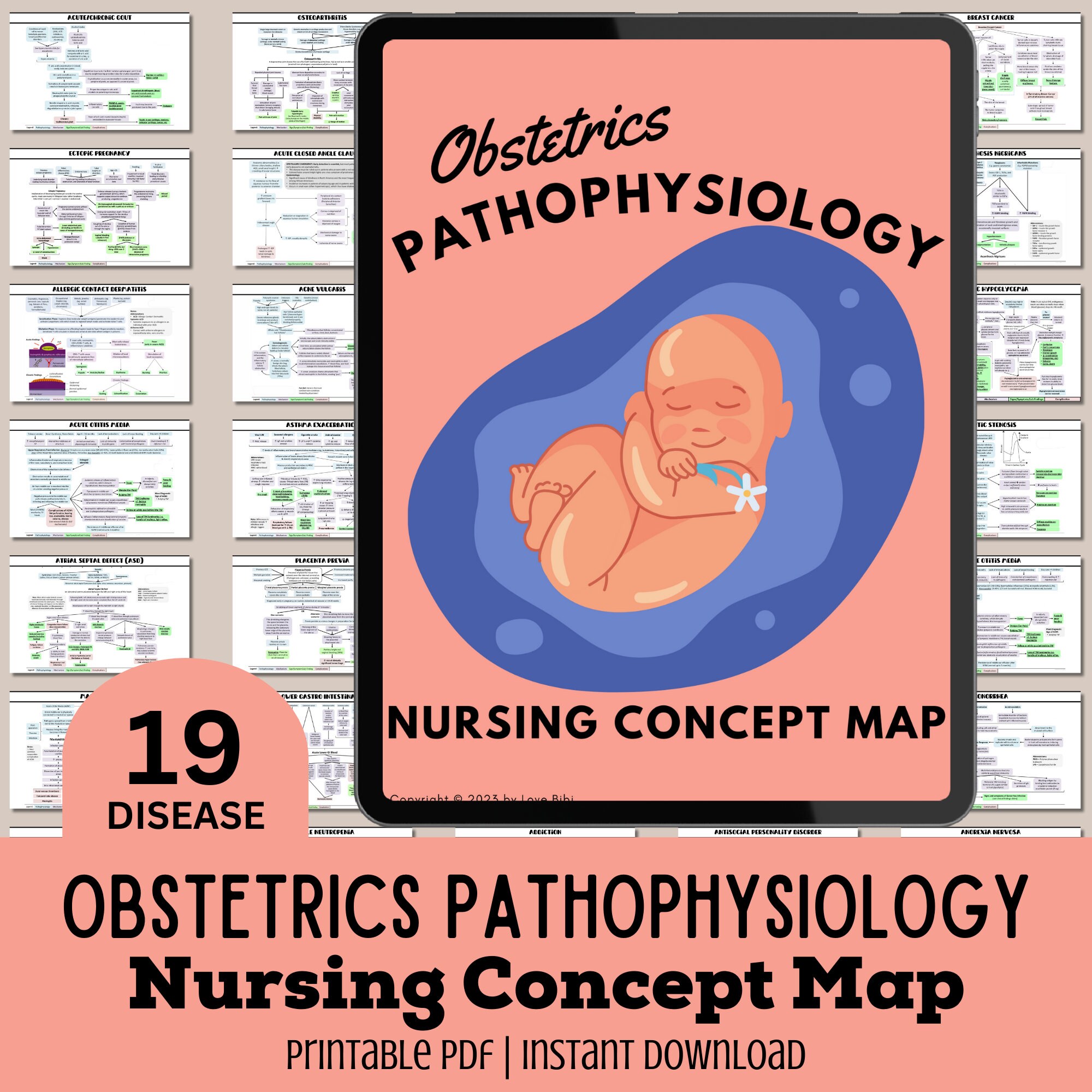 19 Obstetrics Pathophysiology Nursing Concept Map Diseases Pathophysiology Study Guide Ob ...