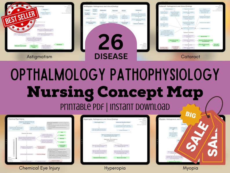 26 Opthalmology Pathophysiology Nursing Concept Map Diseases - Etsy