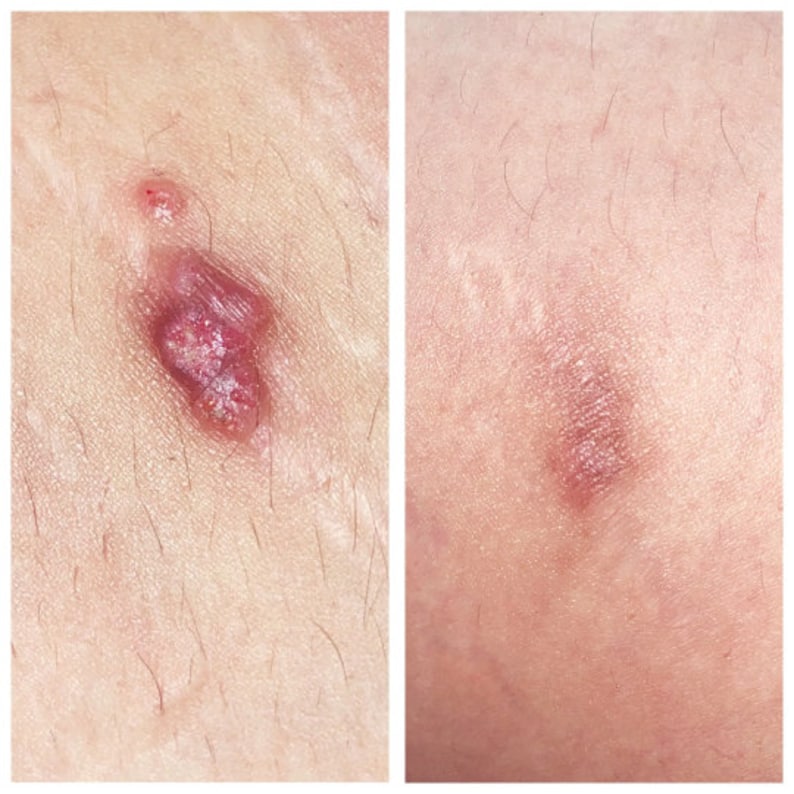 Shea Silk Scrub PLANT BASED Extremely Smooth, Plushy & Silky ...