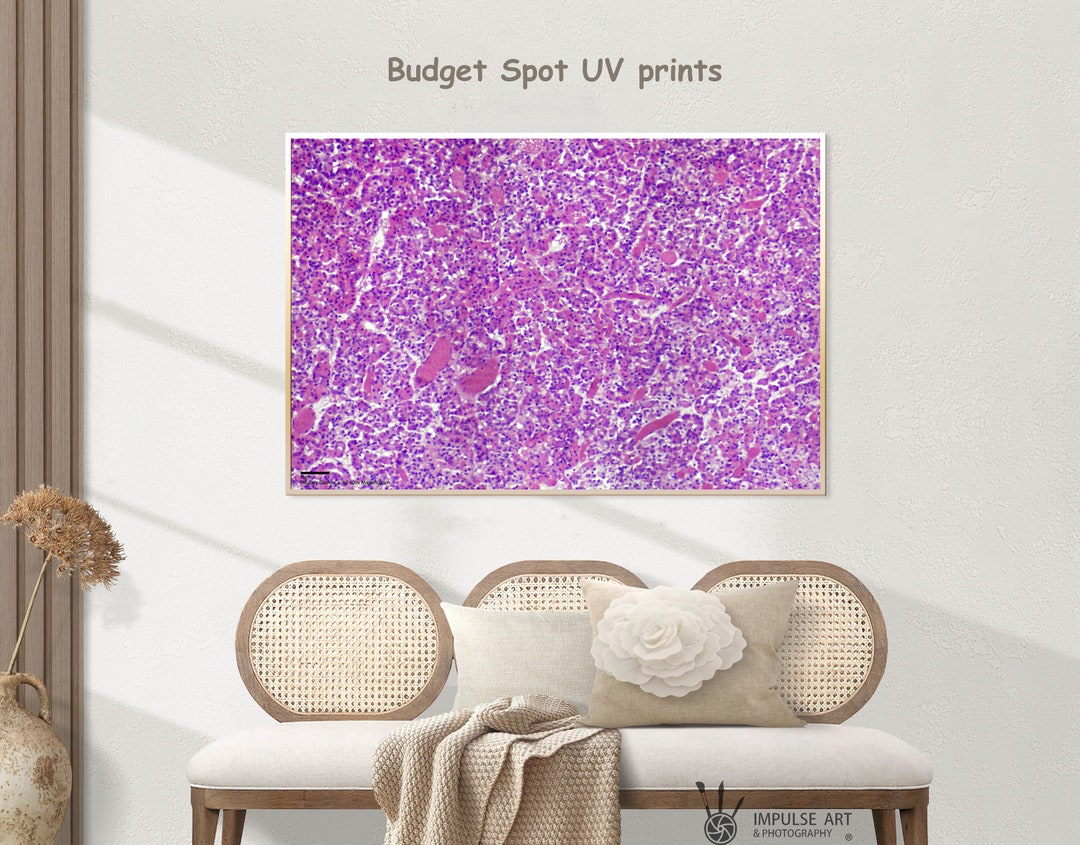 POSTER Pituitary Gland 2 Cells Microscopic Photography Poster - Etsy