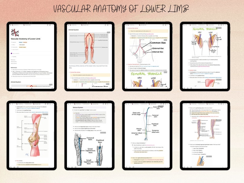 Vascular Surgery Notion Template: Medical Student Notes (digital ...