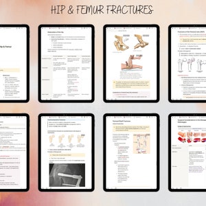 Notion Templates for Medical Students | Medical Notes | Digital Notes ...