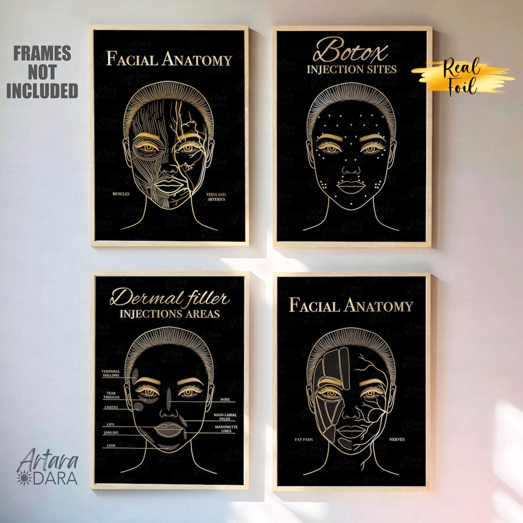Foil Botox Injection Sites & Facial Anatomy Posters - Set of 4 - Etsy