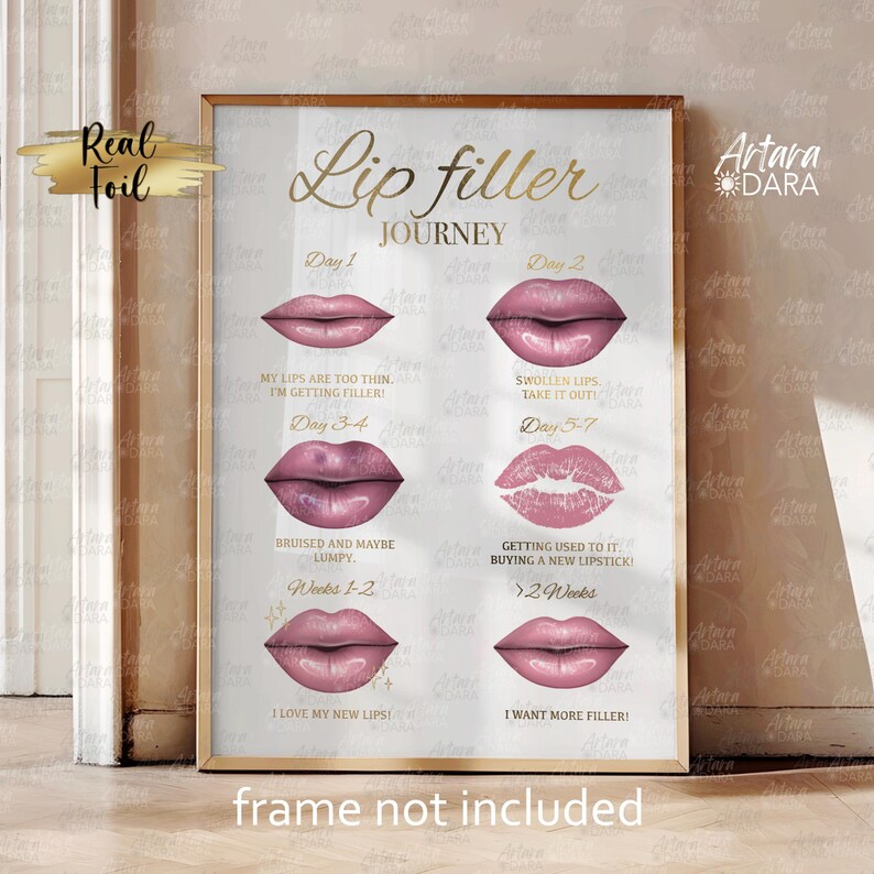 Lip Filler Poster Set – Lips Anatomy, Aftercare, Filler Journey & Quote ...