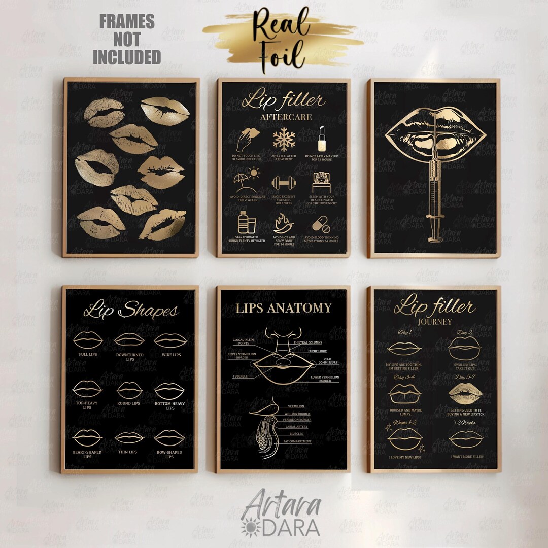 Black & Gold Foil Lip Filler Print Set – Anatomy, Aftercare Art - Etsy