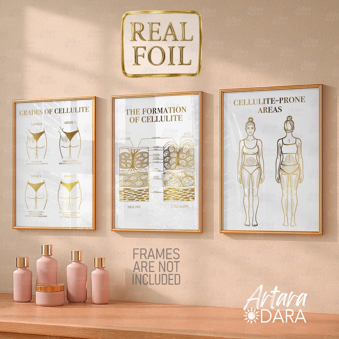 Gold Foil Body Sculpting Poster Set – Cellulite Charts (unframed) - Etsy