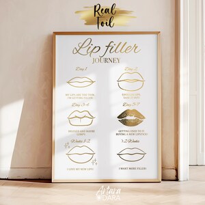 Lip Filler Poster, Real Foil Print, Lip Augmentation Art, Lip Filler ...