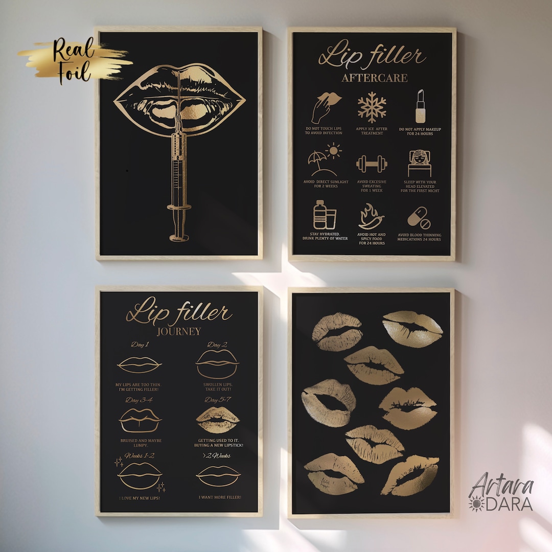 4 Lip Filler Poster, Beauty Salon Decor, Lip Augmentation Art, Real ...