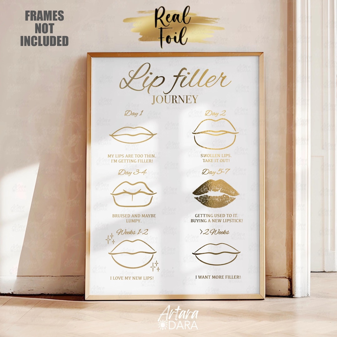 Lip Filler Poster, Real Foil Print, Lip Augmentation Art, Lip Filler ...