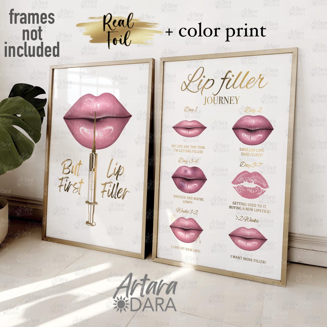 Lip Filler Journey, Lip Filler Poster, Real Foil Print, Beauty Salon ...