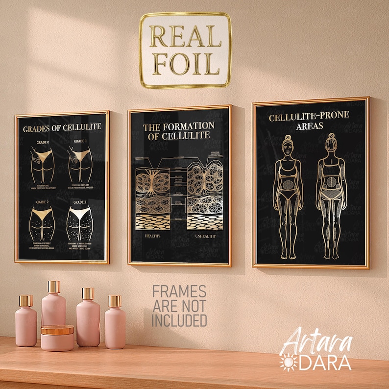 Cellulite Anatomy Poster Set of 3 – Gold Foil Med Spa Wall Art ...