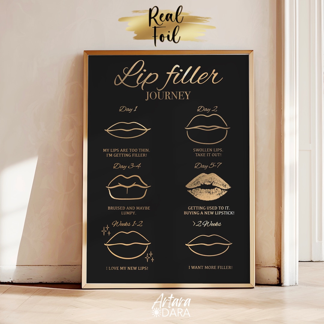 Lip Filler Journey, Real Foil Print, Lip Filler Poster, Beauty Salon ...