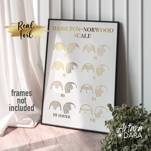 Hair Loss Scales, Real Foil Print, Hair Anatomy Art, Hair Growth Cycle ...