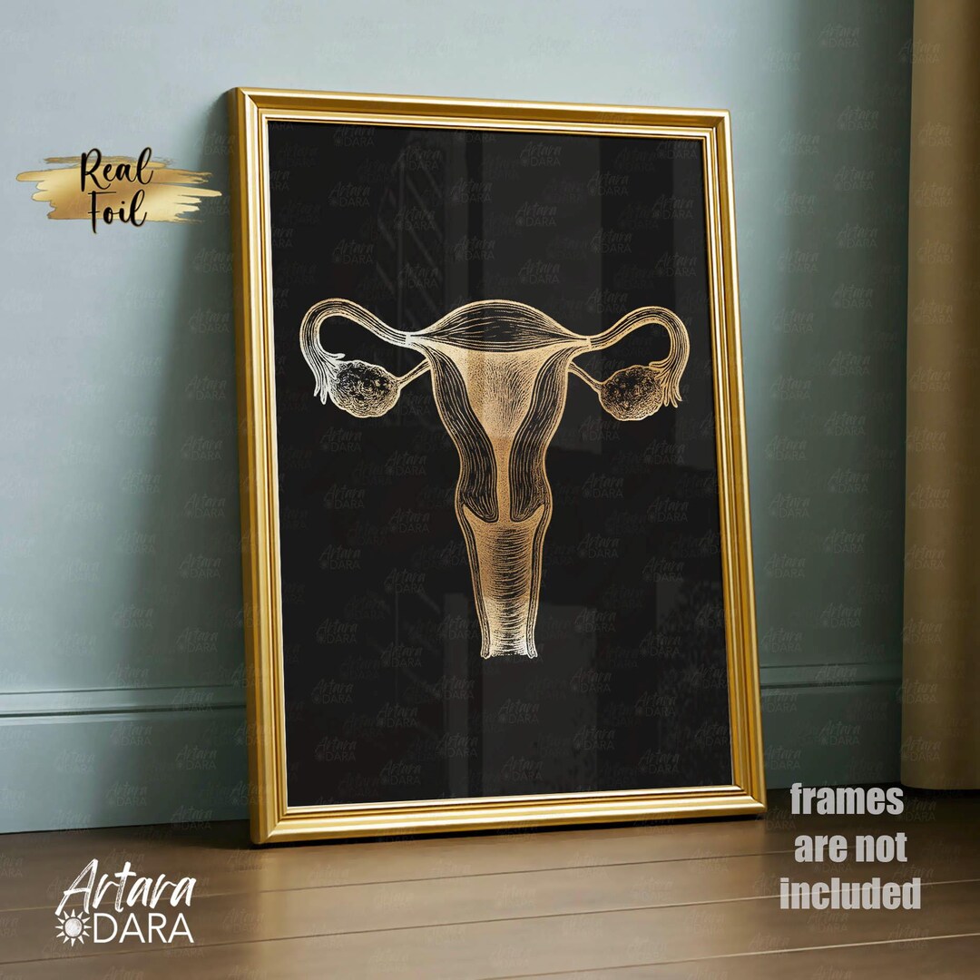Uterus & Ovaries Gold Foil Poster – Female Anatomy Wall Art (unframed ...