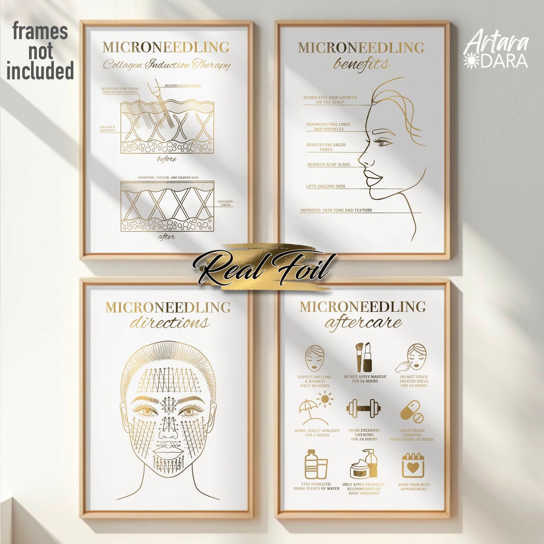 Microneedling Poster, Microneedling Benefits, Real Foil Print, Beauty ...