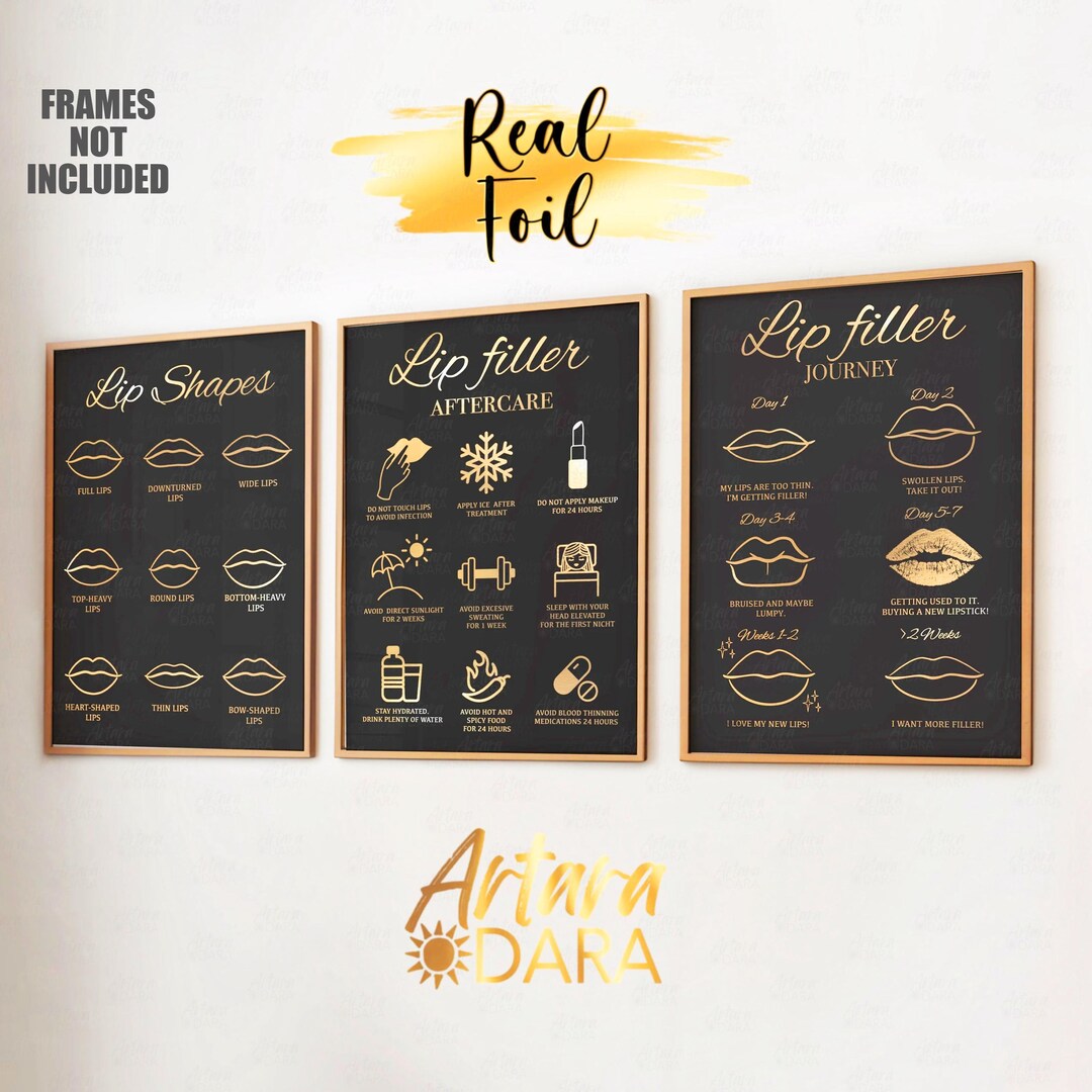 Lip Filler Art, Real Foil Print, Lip Filler Journey, Lip Filler ...