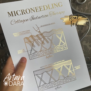 3 Microneedling Prints, Real Foil Print, Microneedling Aftercare ...