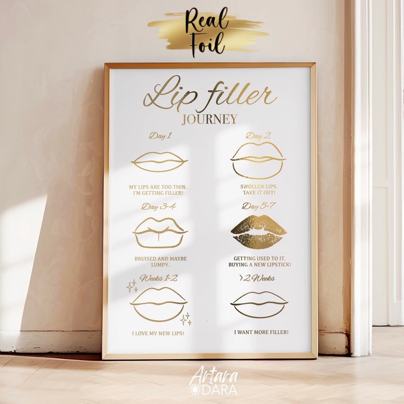 Lip Filler Posters, Real Foil Print, Lip Anatomy Art, Beauty Salon ...