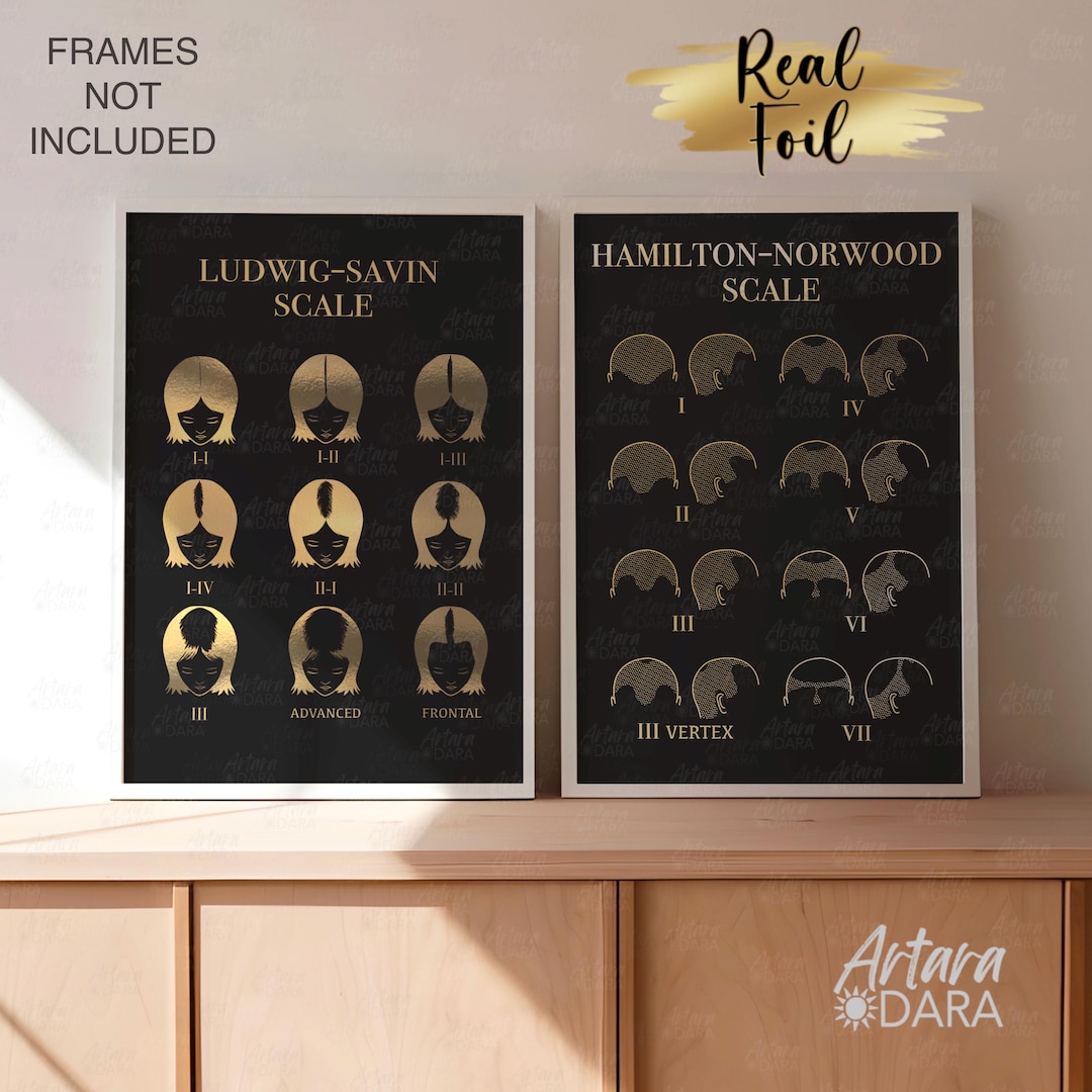 Ludwig Savin Scale, Real Foil Print, Hamilton Norwood Scale, Hair ...