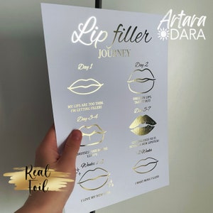 Lip Filler Poster, Real Foil Print, Lip Augmentation Art, Lip Filler ...