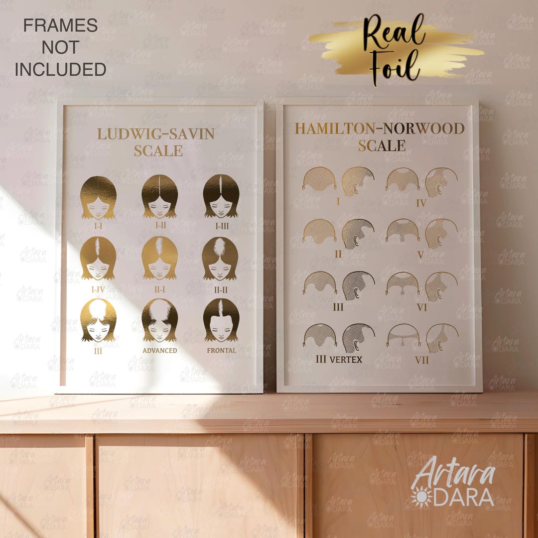 Norwood Scale, Ludwig Savin Scale, Hair Loss Scale, Real Foil Print ...