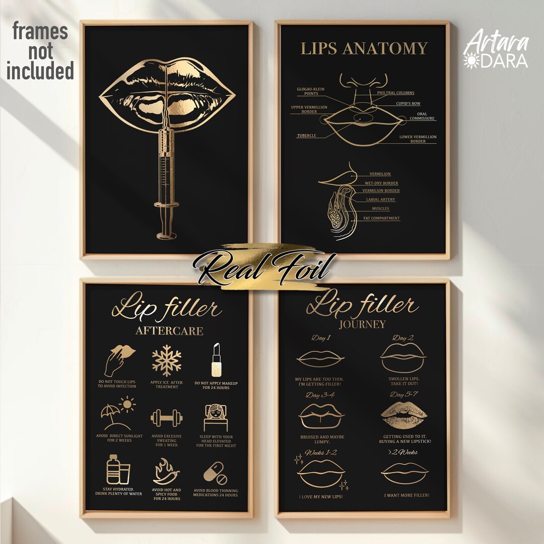 Lip Filler Poster, Real Foil Print, Lip Filler Aftercare, Lips Anatomy ...