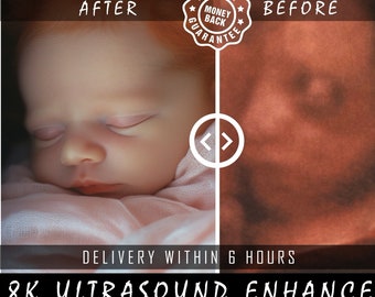 8K Enhanced Ultrasound: From Bumps to Realistic Faces Precision 3D/4D/5D/HD Imaging Perfect Baby ...