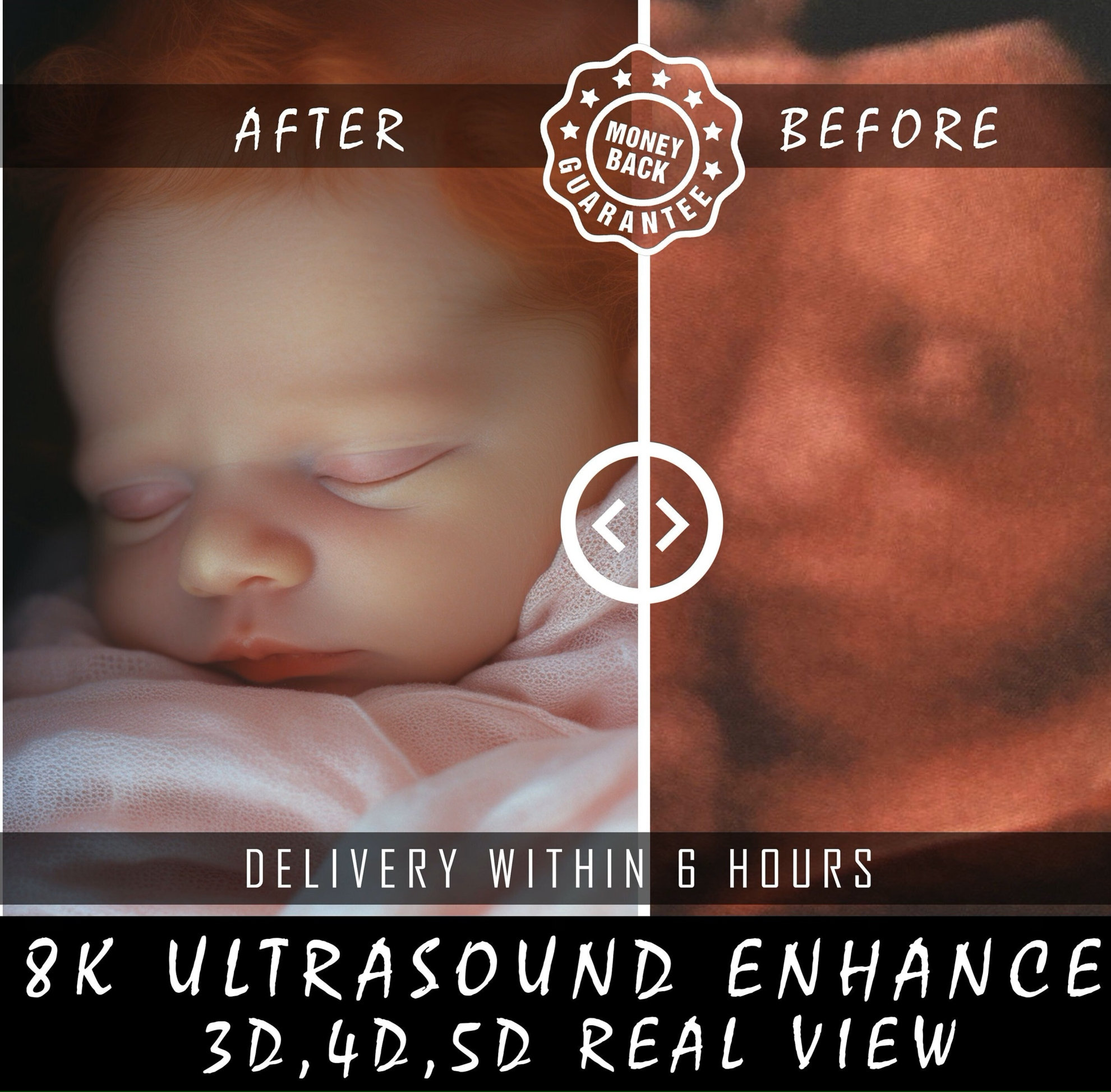 Ultrasound 8K Enhanced Ultrasound: From Bumps to Realistic Faces ...
