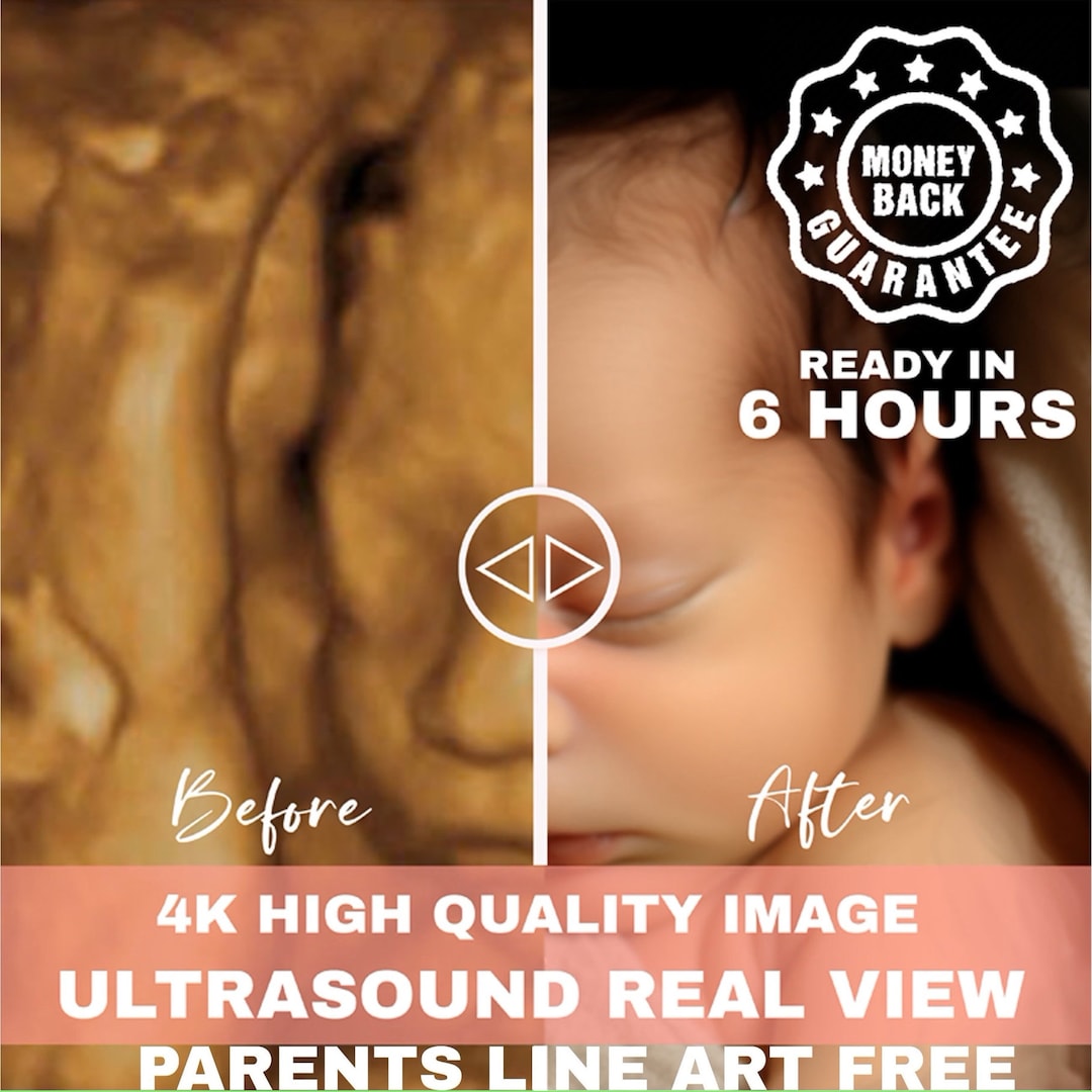 Ultrasound 8k Baby Image 3d 4d 5d 8d Real View Baby AI Photo ...