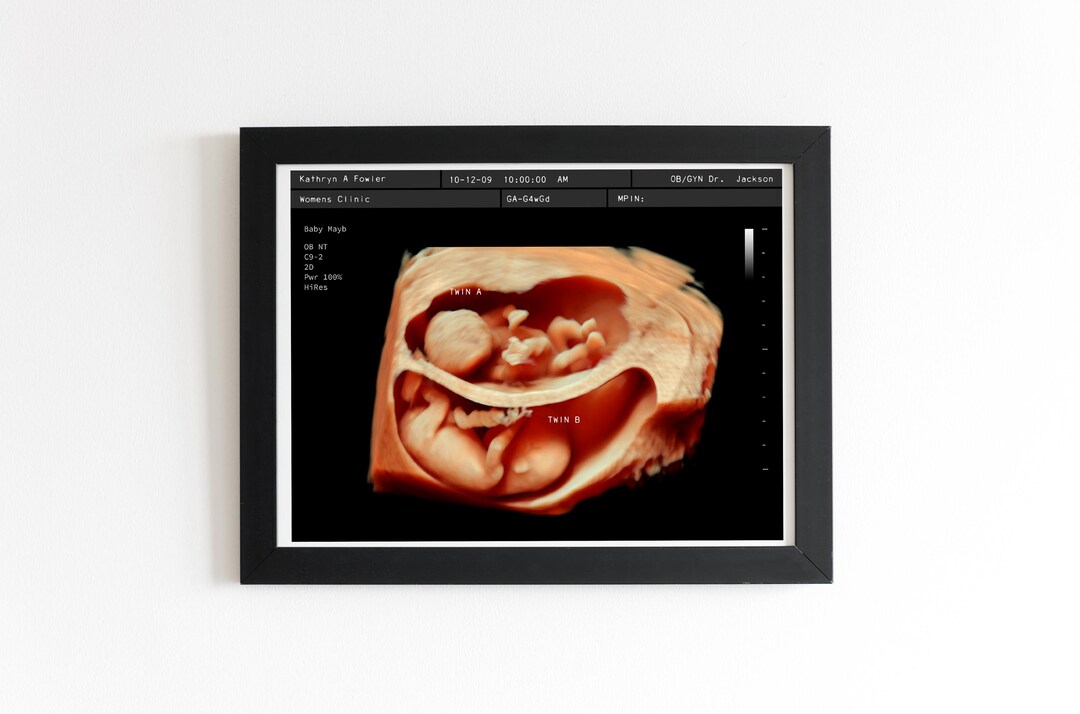 Fake Ultrasound Prank With Husband Echography Scans First Baby Scan ...