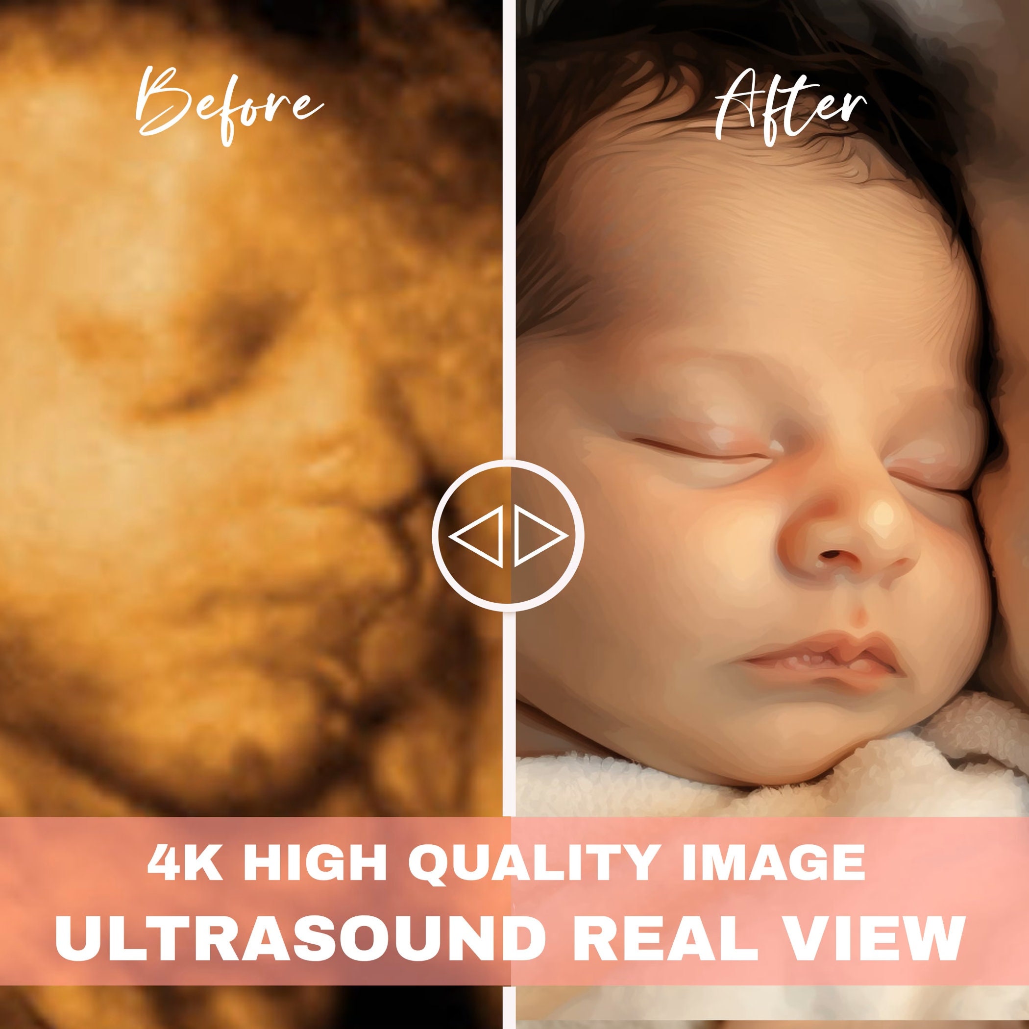 Ultrasound 8K Enhanced Ultrasound: From Bumps to Realistic Faces ...