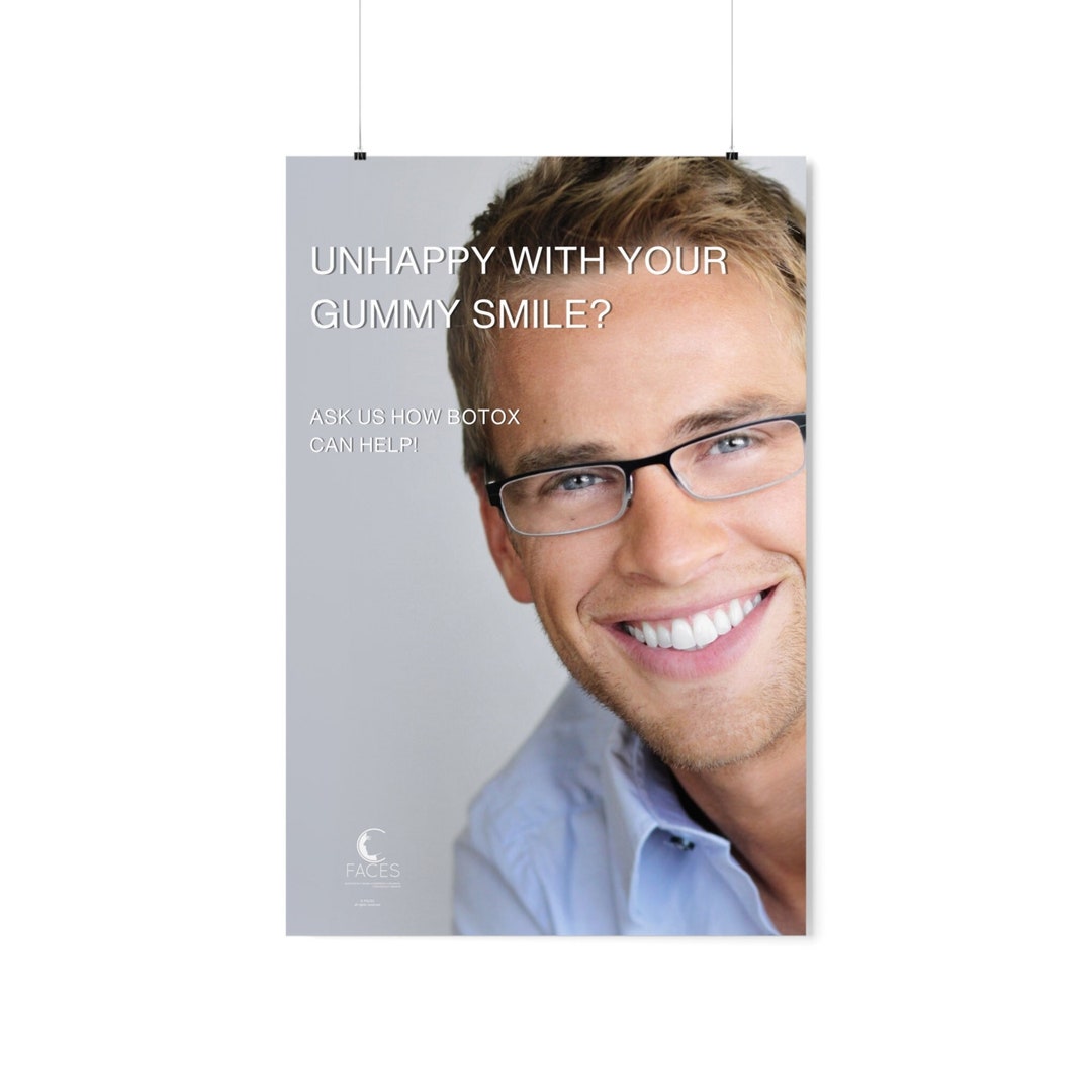 FACES Gummy Smile Poster for Dental Office - Etsy