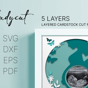 Ultrasound Picture Frame Shadow Box, 3D Baby Scan Picture Shadow Box ...