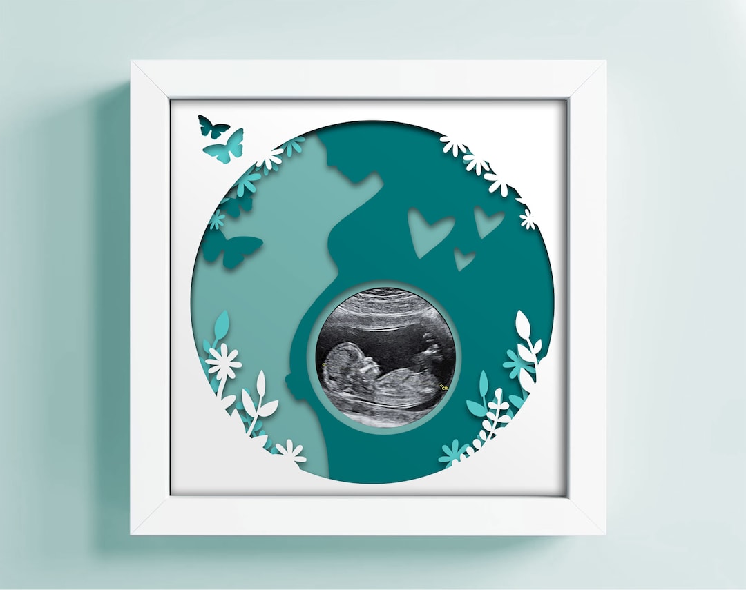 Ultrasound Picture Frame Shadow Box, 3D Baby Scan Picture Shadow Box ...