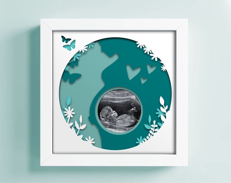 Ultrasound Picture Frame Shadow Box 3D Baby Scan Picture - Etsy