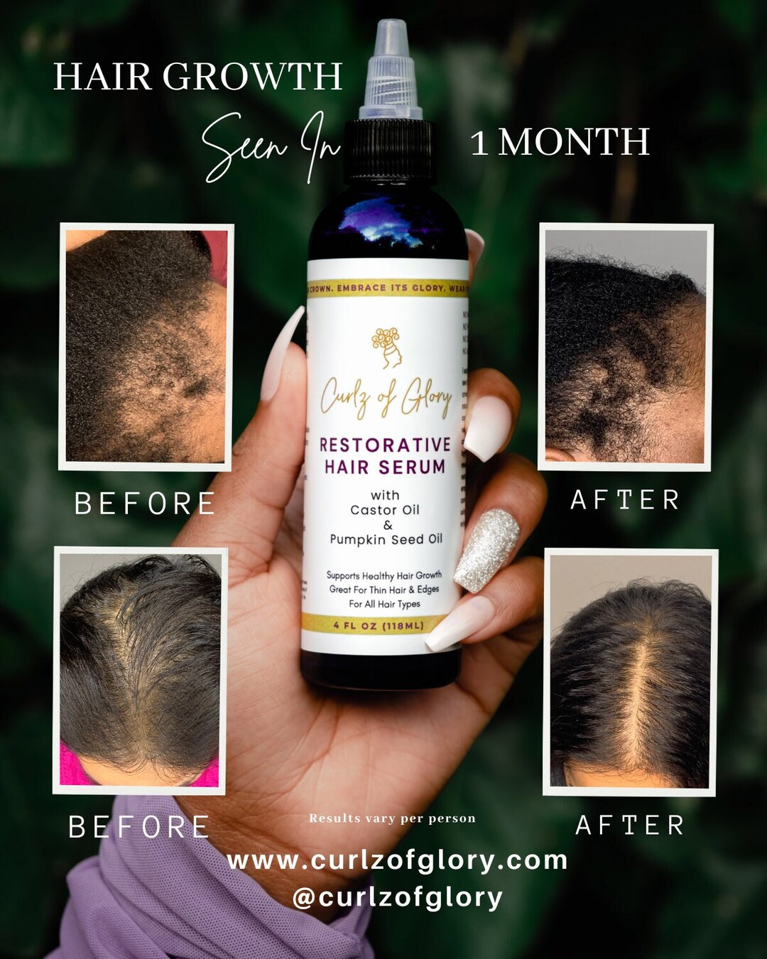 Restorative Hair Serum, Hair Growth Oil for All Hair Types, Natural ...