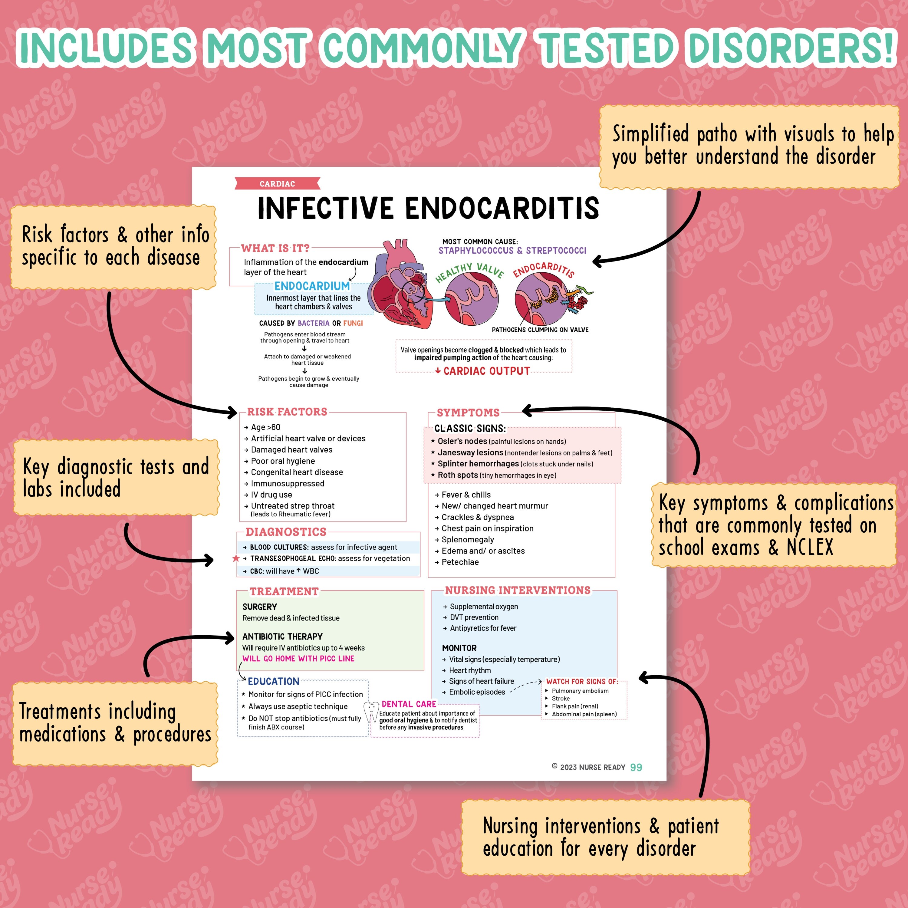 Cardiac Nursing Notes Study Bundle - Etsy Australia