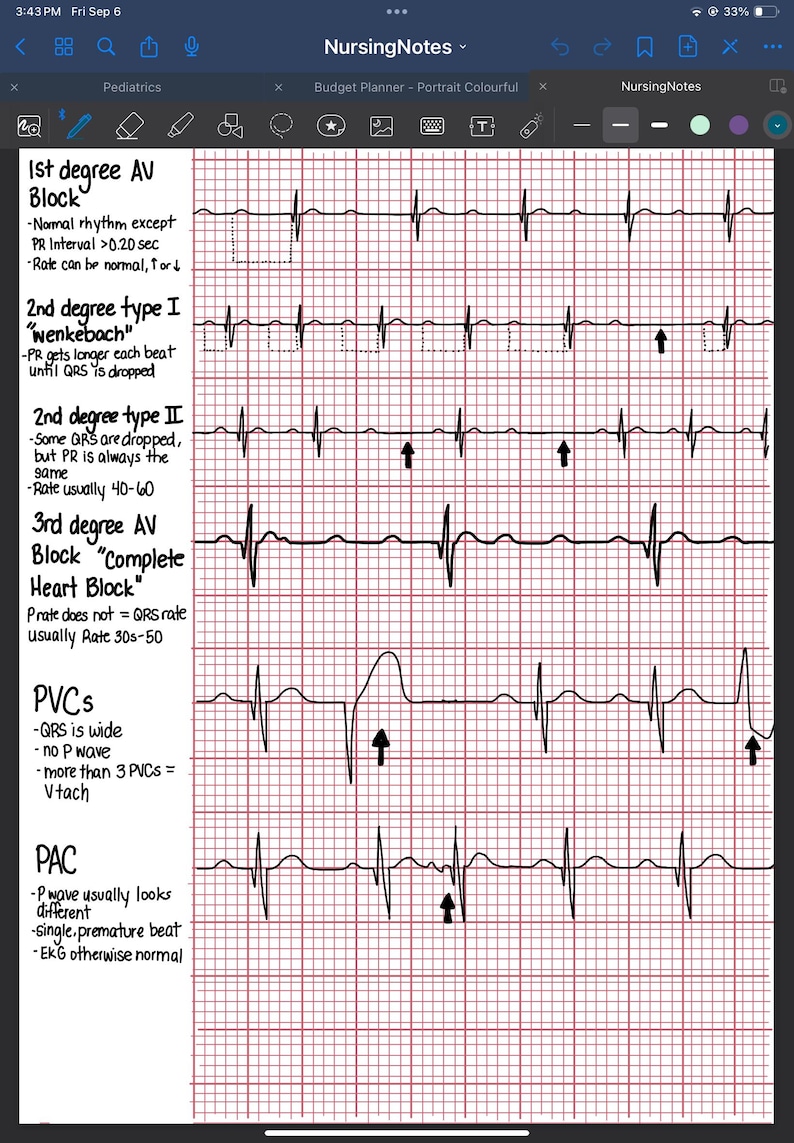 Cardiology Notes - Etsy