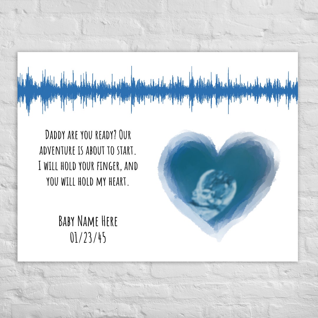 Sonogram & Heartbeat Waveform Digital Print - Personalized Gift for ...