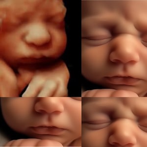 Ultrasaund 8k Baby Image 3d 4d 5d 8d Real View Baby AI Photo ...