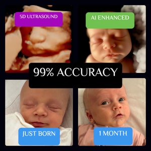 Ultrasaund 8k Baby Image 3d 4d 5d 8d Real View Baby AI Photo ...