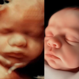 Ultrasaund 8k Baby Image 3d 4d 5d 8d Real View Baby AI Photo ...