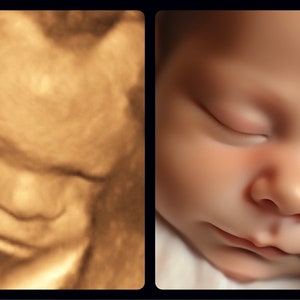 Ultrasaund 8k Baby Image 3d 4d 5d 8d Real View Baby AI Photo ...