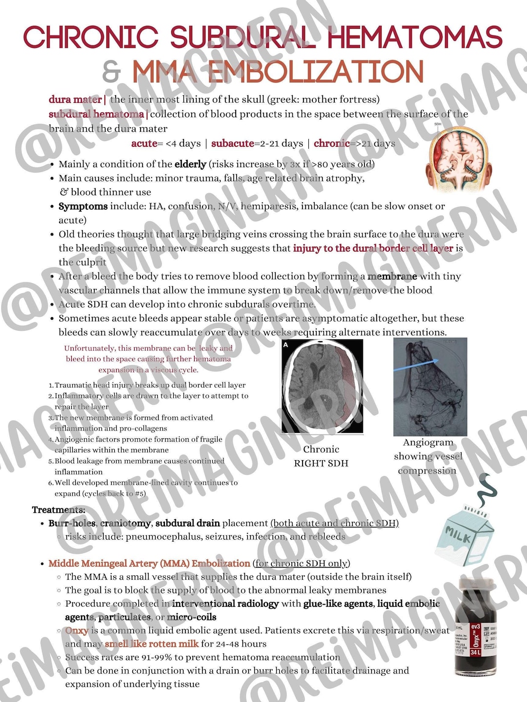 Chronic Subdural Hematoma and MMA Embolization - Etsy