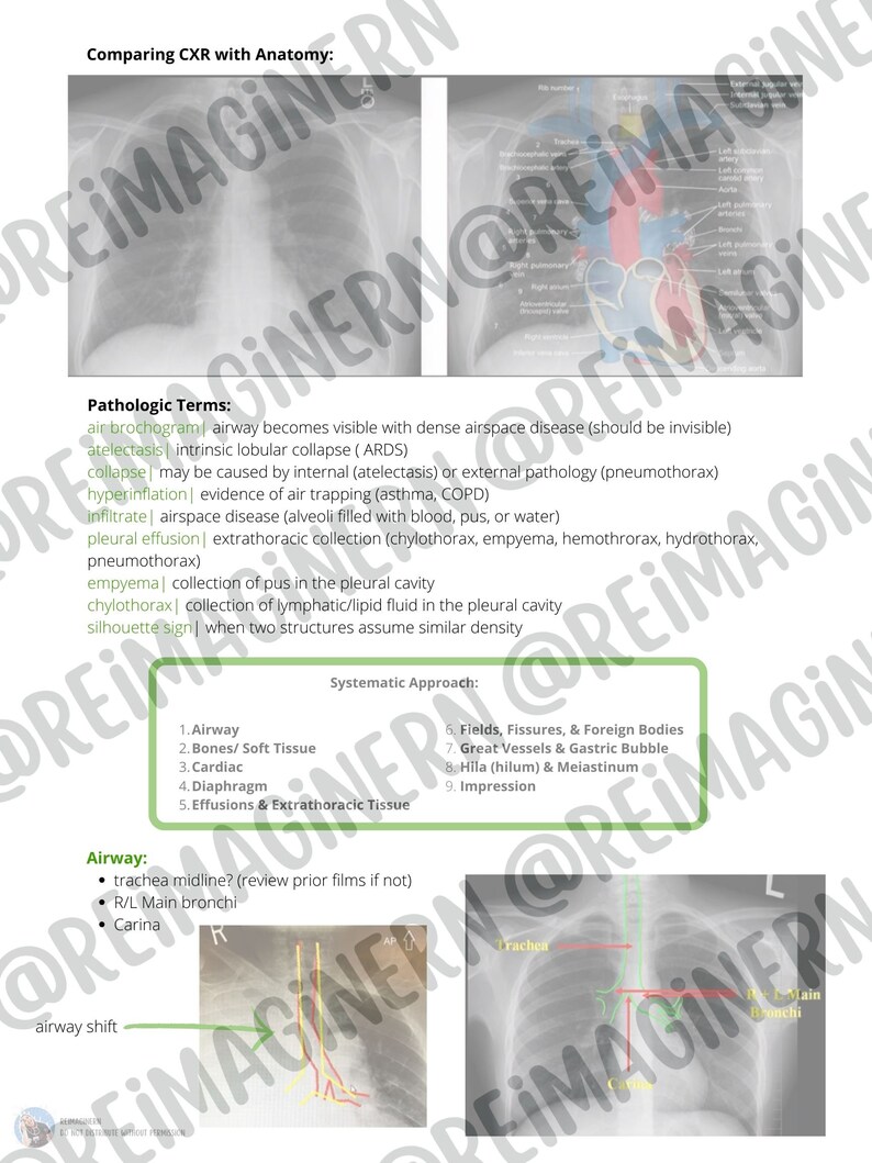 Chest Radiograph Interpretation - Etsy