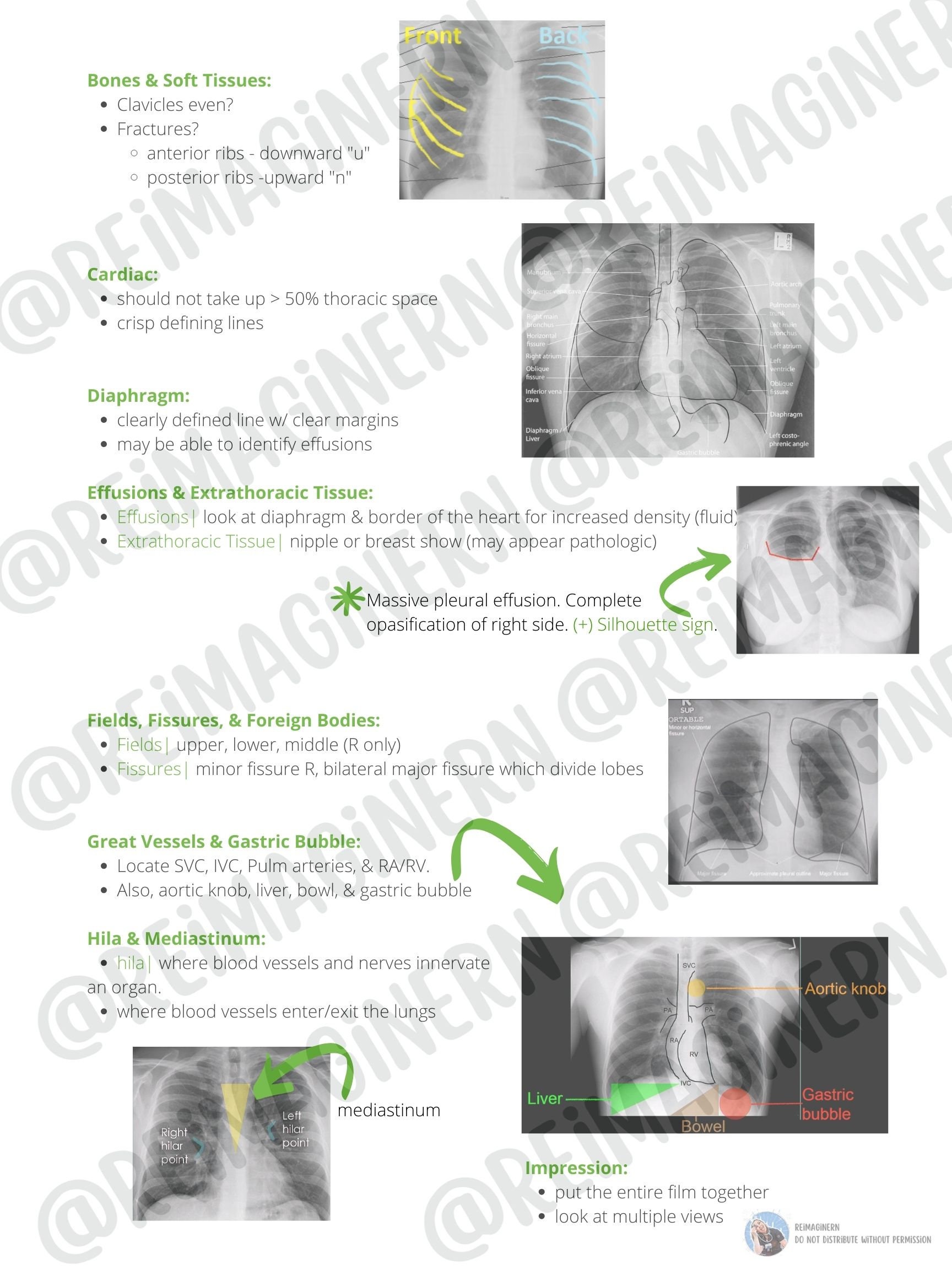 Chest Radiograph Interpretation - Etsy