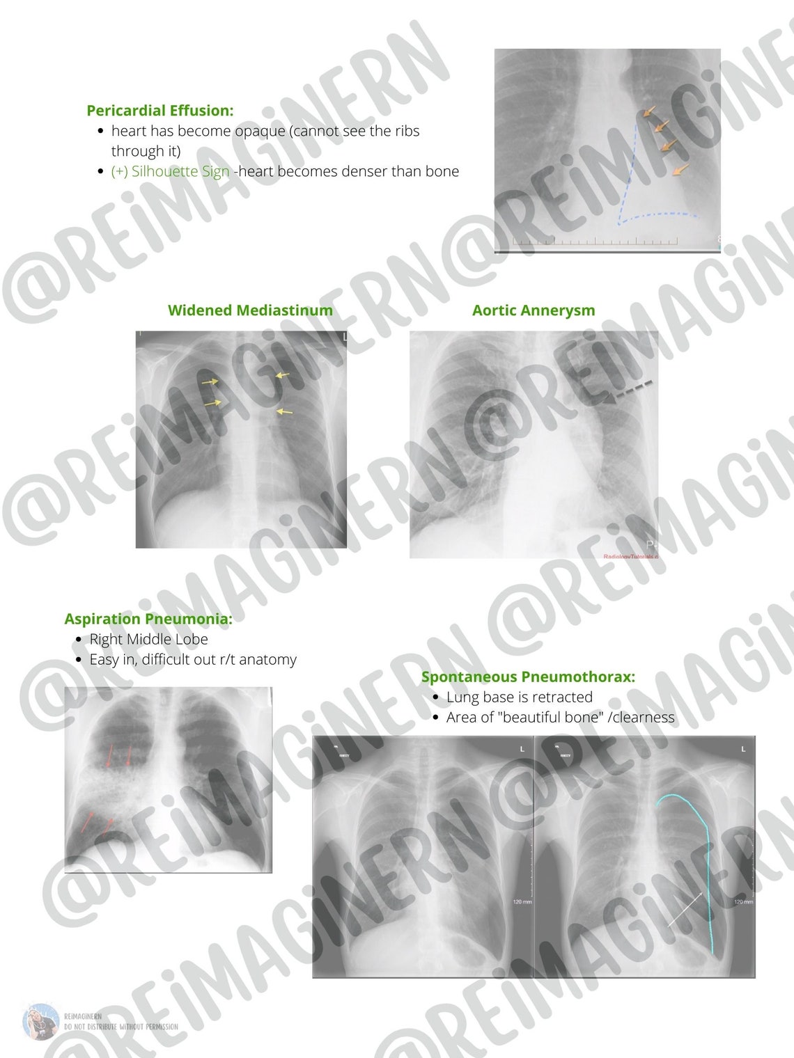 Chest Radiograph Interpretation - Etsy