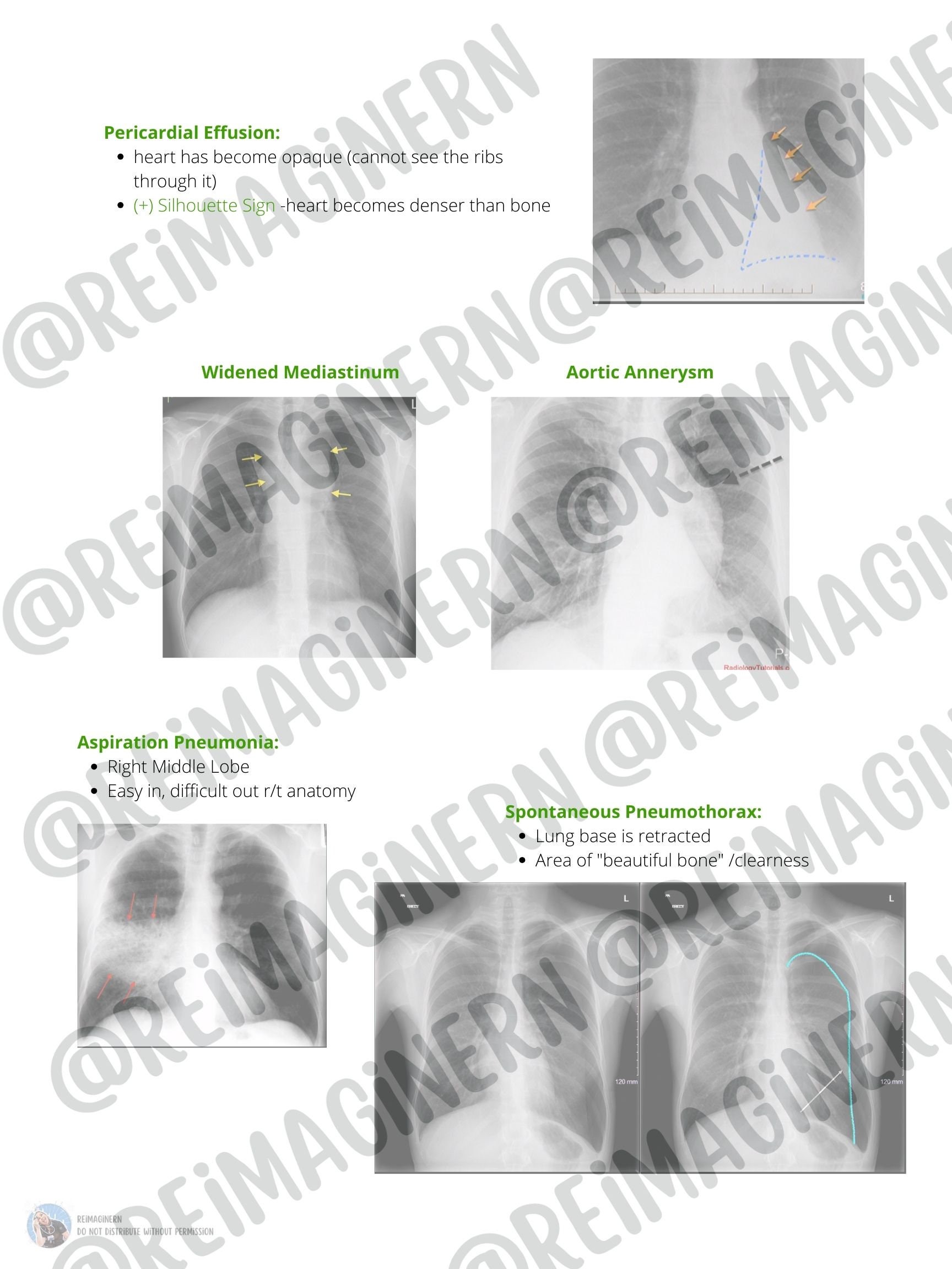 Chest Radiograph Interpretation - Etsy