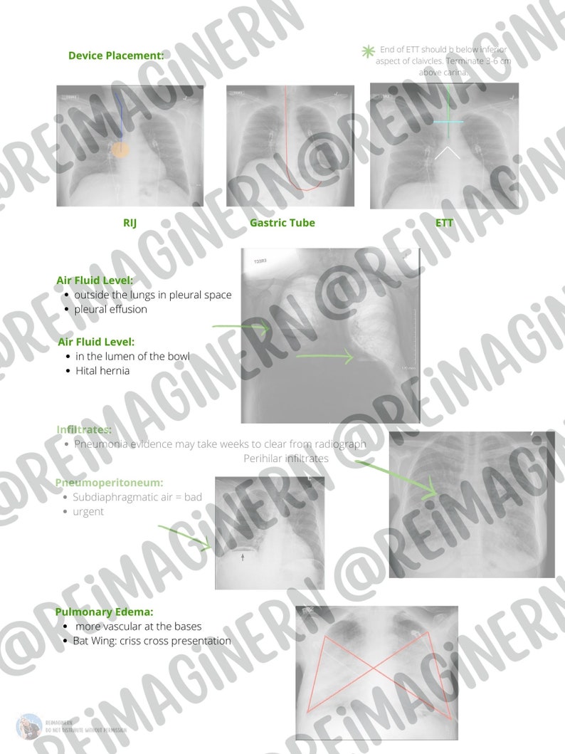 Chest Radiograph Interpretation - Etsy