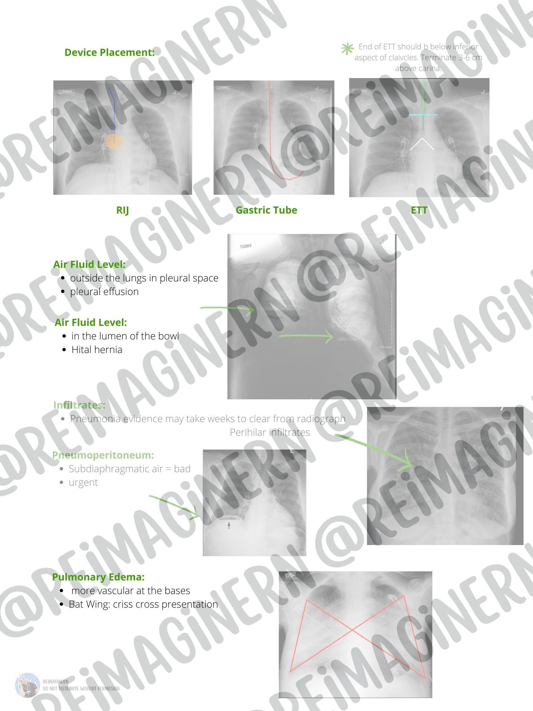 Chest Radiograph Interpretation - Etsy